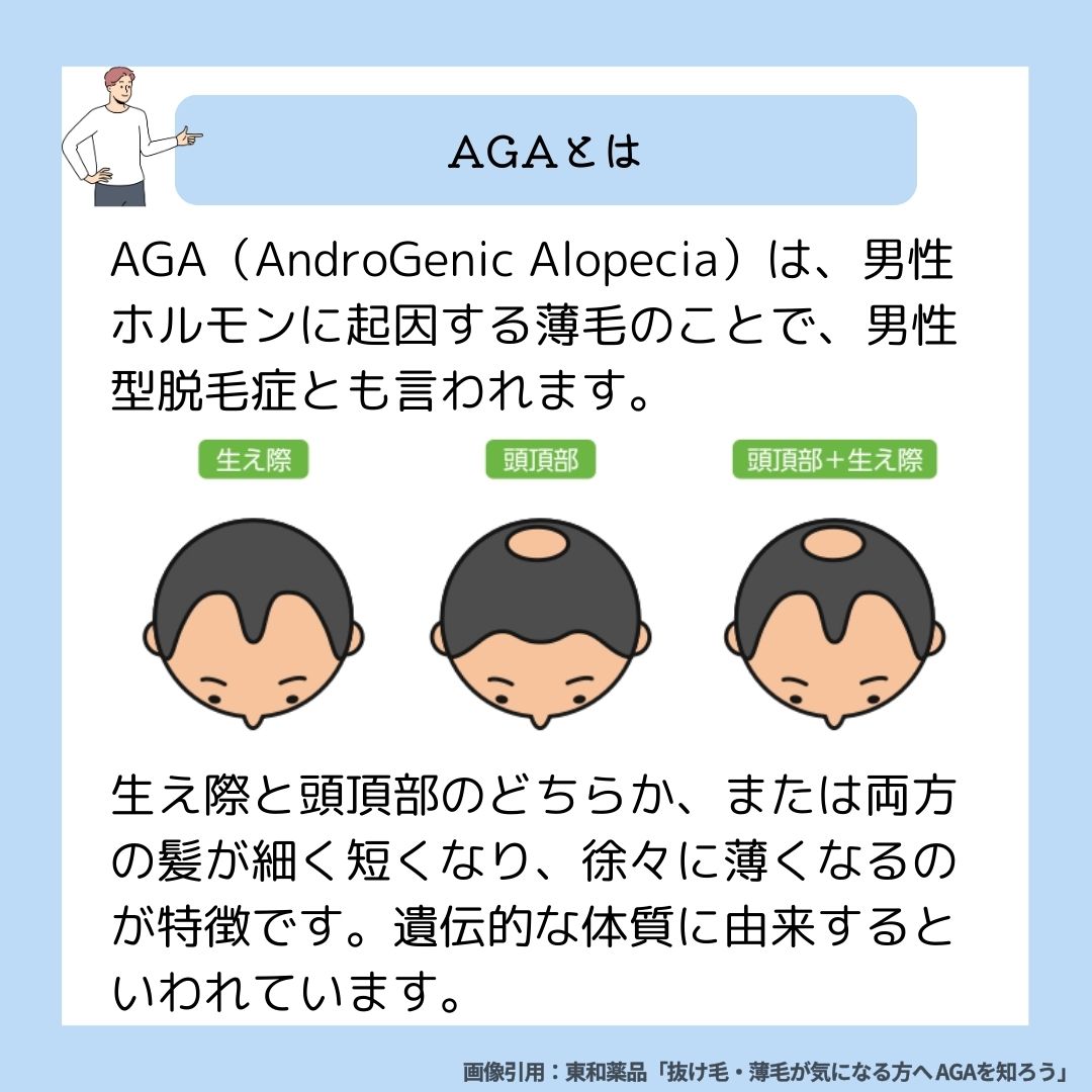 AGA全般についてわかりやすく解説！AGAとは、その治療・副作用・費用について - 福岡市天神の内科・糖尿病内科｜19時まで診療| なないろクリニック